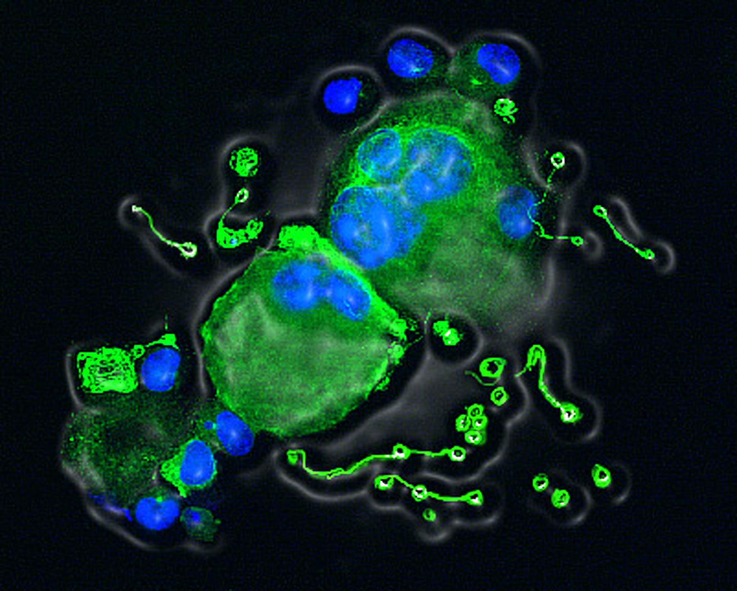 CNIO scientists discover a new blood platelet | EurekAlert!