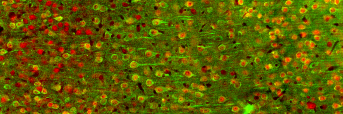 Insular cortex [IMAGE] | EurekAlert! Science News Releases