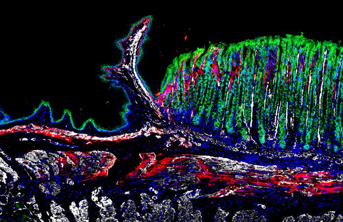 Gastroesophageal Junction [IMAGE] | EurekAlert! Science News Releases