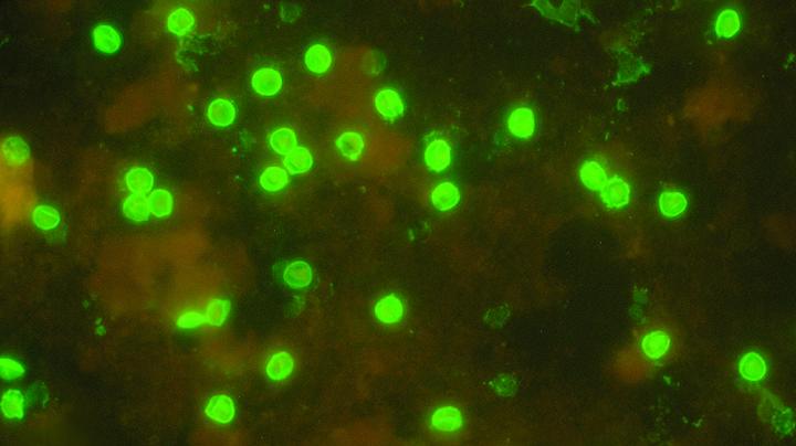 Cryptosporidium Oocysts [IMAGE] | EurekAlert! Science News Releases