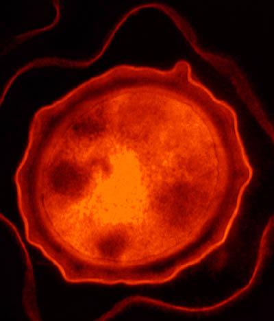 Anthrax Microbe [IMAGE] | EurekAlert! Science News Releases