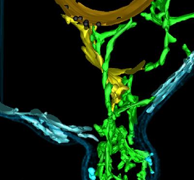 Diversity of ER Structures | EurekAlert!