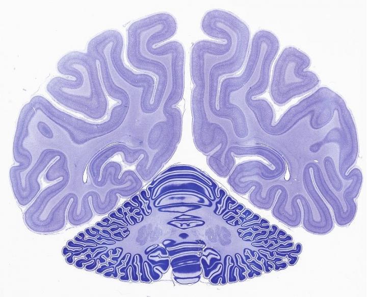 Primate Brain Development [IMAGE] | EurekAlert! Science News Releases