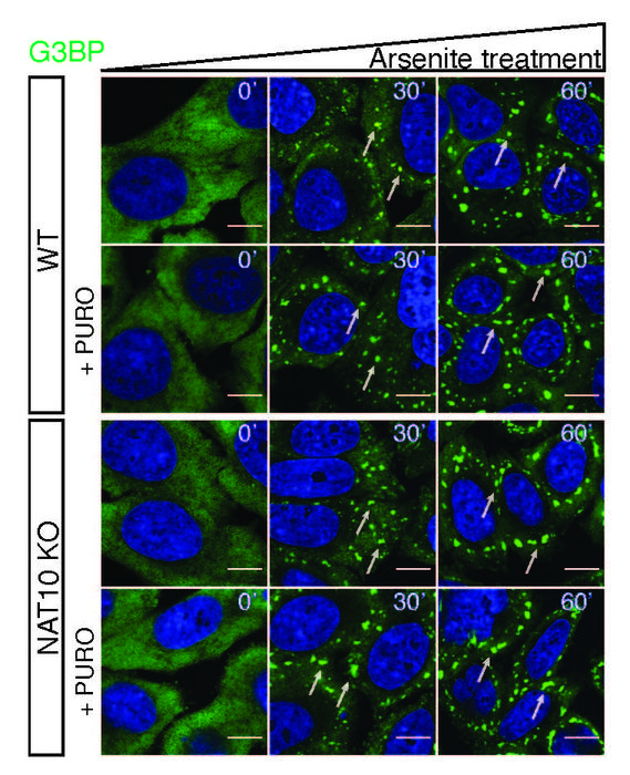 Stress granule formation [IMAGE] | EurekAlert! Science News Releases