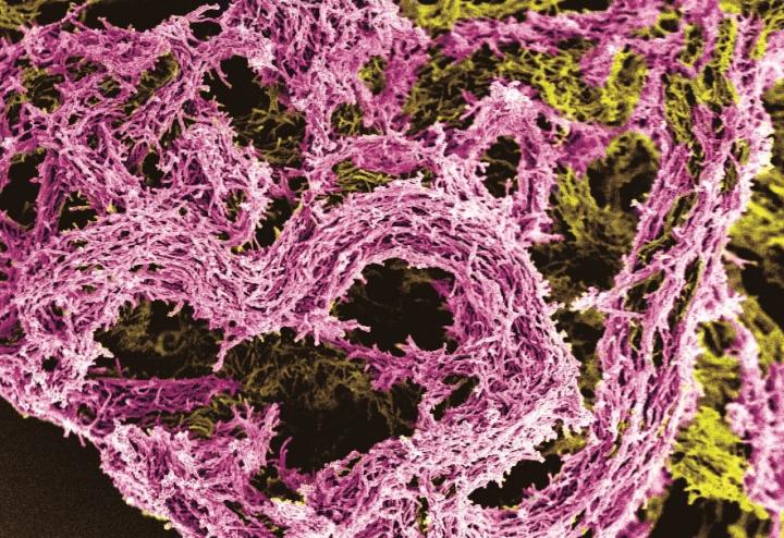 Mycobacterium bovis BCG [IMAGE] | EurekAlert! Science News Releases