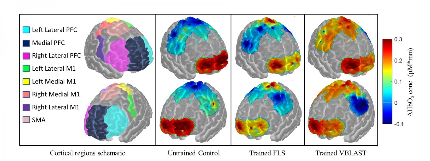 Brain Mapping [IMAGE] | EurekAlert! Science News Releases