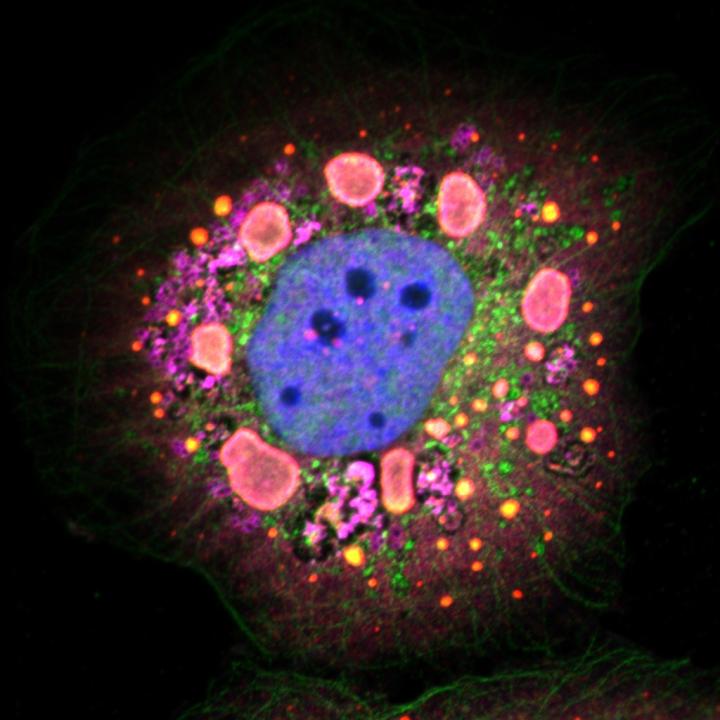 Reovirus-infected Epithelial C [IMAGE] | EurekAlert! Science News Releases