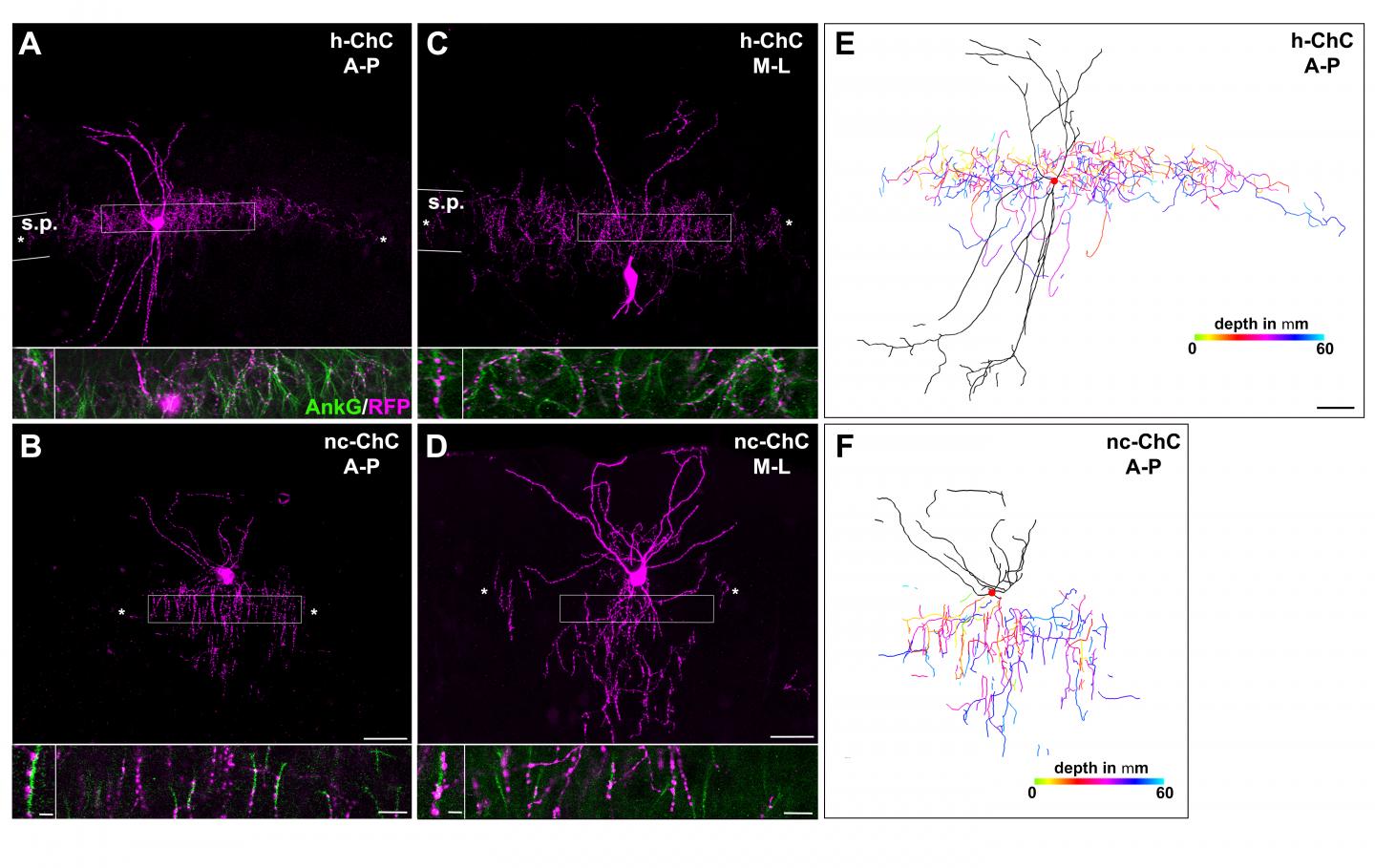 Hippocampal Chandelier Cells I [IMAGE] | EurekAlert! Science News Releases
