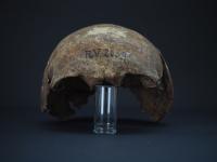 This 5,000-year-old man had the earliest know | EurekAlert!