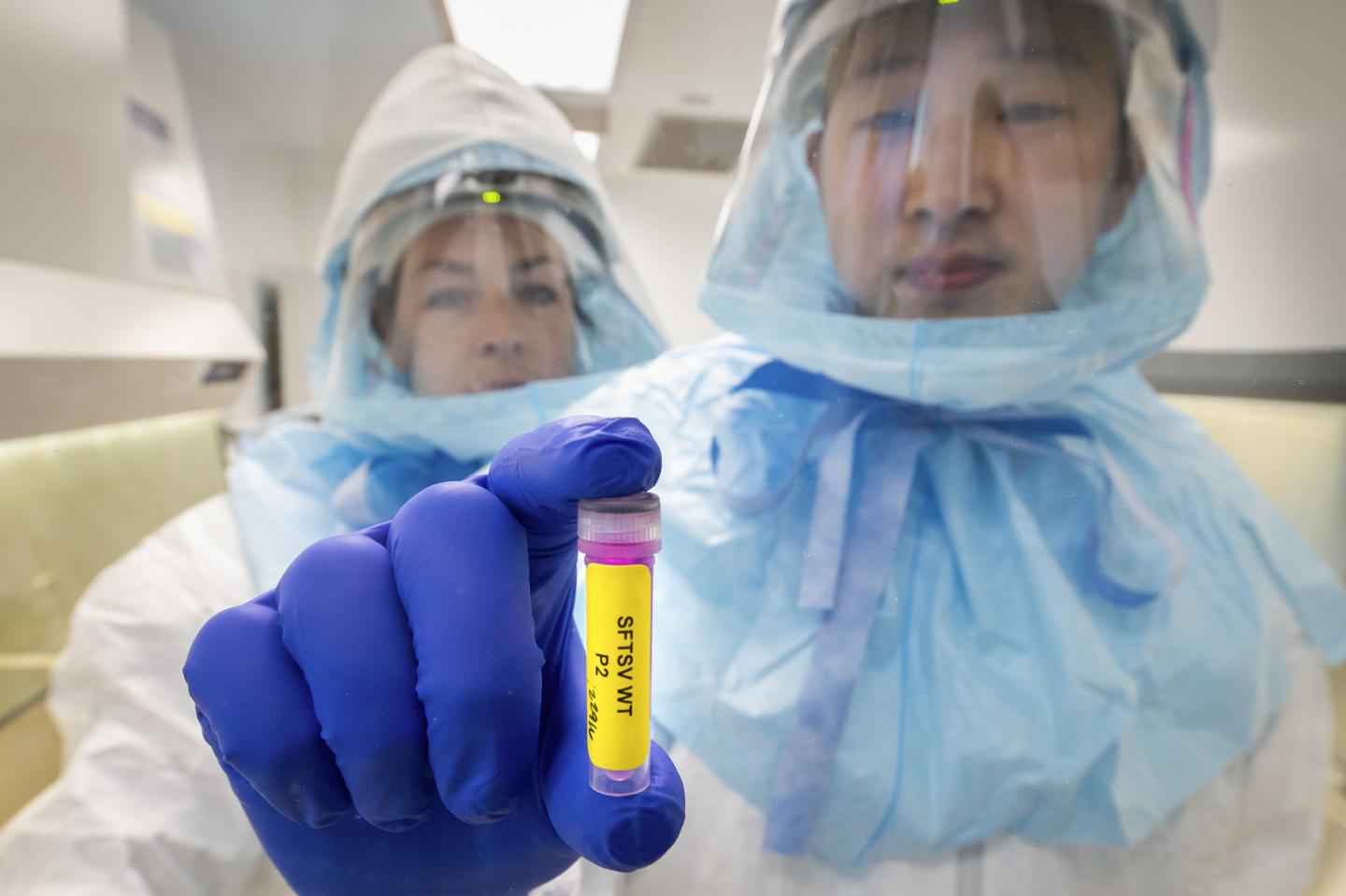 SFTS Virus in a Test Tube [IMAGE] | EurekAlert! Science News Releases