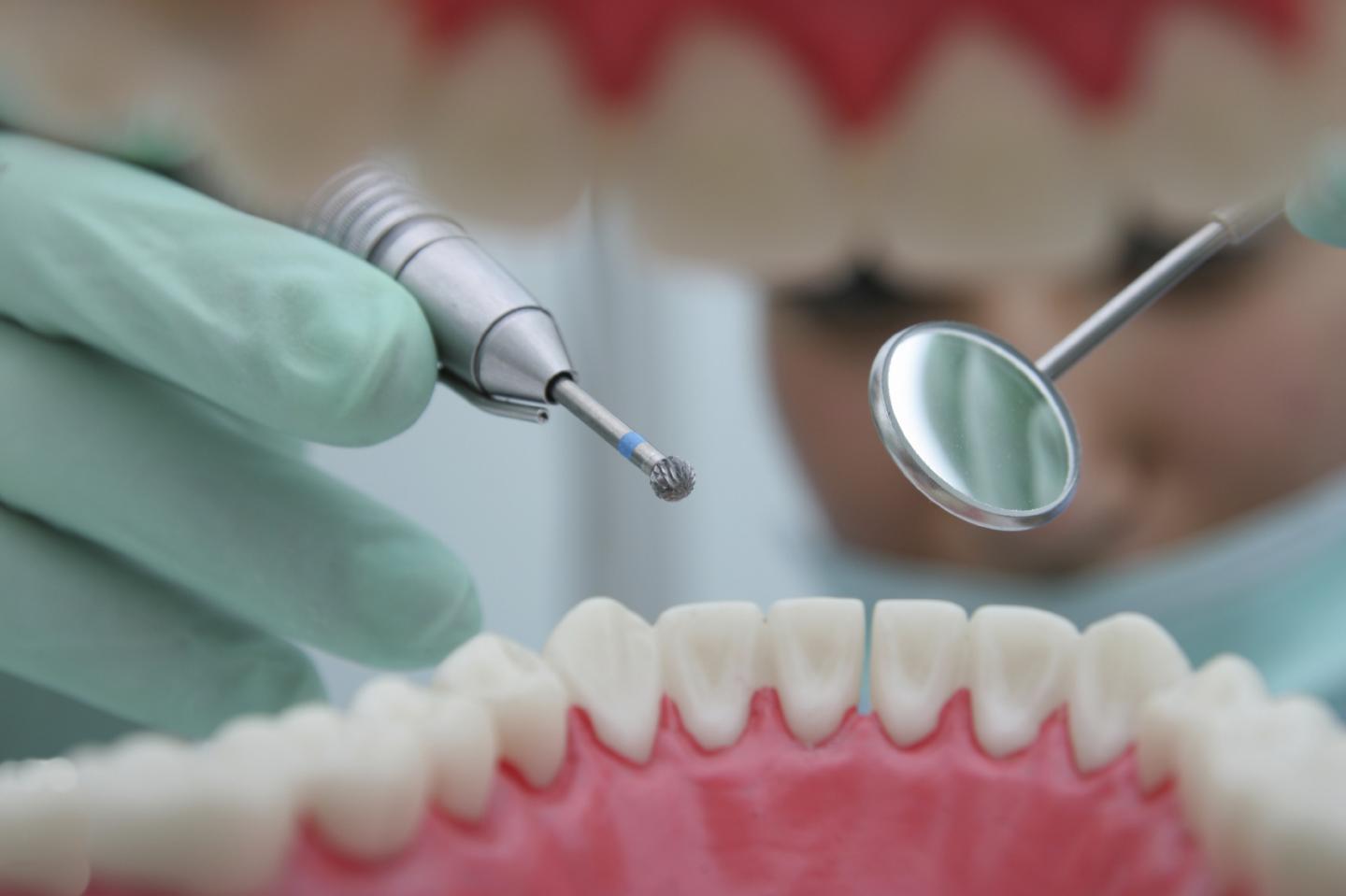 Australian Study Finds no drill Dentistry S EurekAlert 