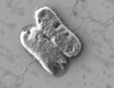 Bile sends mixed signals to E. coli | EurekAlert!