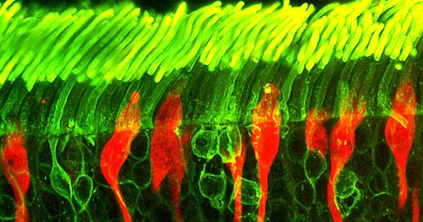 Rods and Cones [IMAGE] | EurekAlert! Science News Releases
