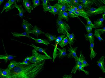 Gene for Rare Growth Condition Identified (2 | EurekAlert!