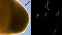 Neuromuscular organoid: It's contracting! | EurekAlert!