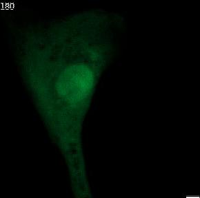 Nuclear Shape Abnormalities [IMAGE] | EurekAlert! Science News Releases
