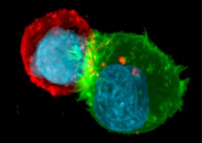 Actin cytoskeleton remodeling protects tumor | EurekAlert!