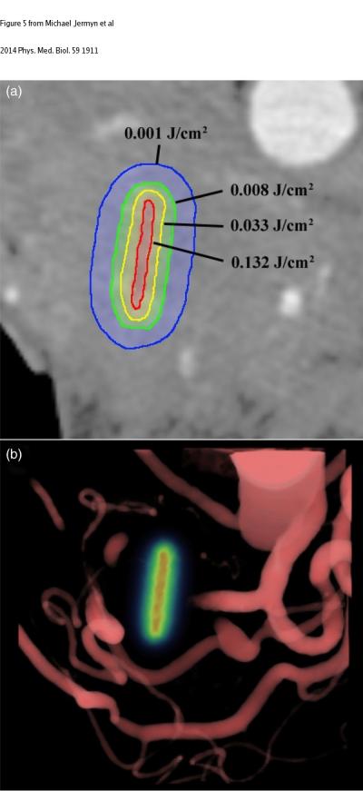 Single Axial Slice of the Panc [IMAGE] | EurekAlert! Science News Releases