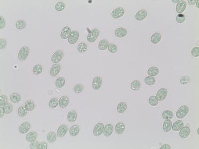 Model helps pinpoint cyanobacterial genes tha | EurekAlert!