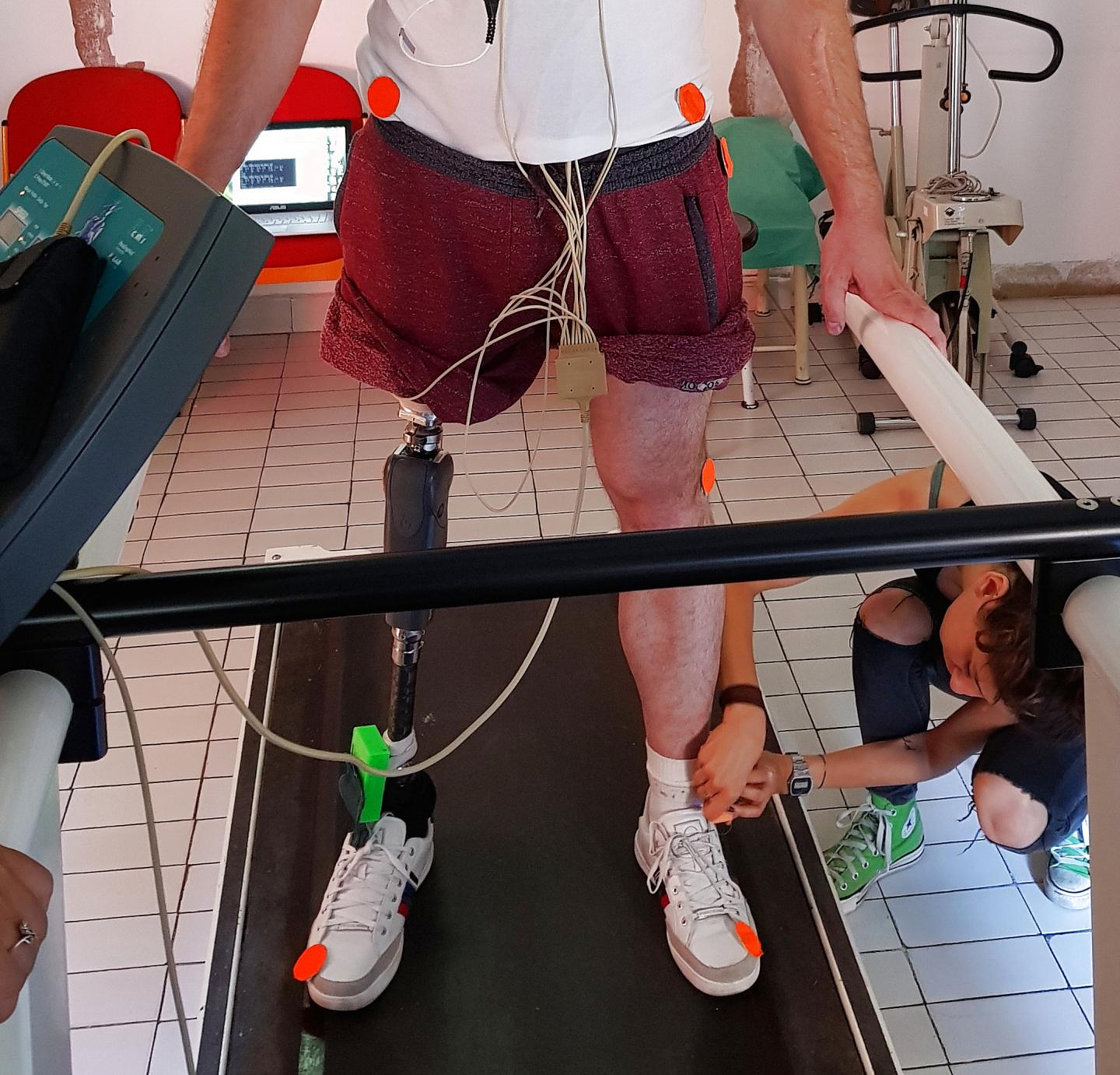 Nerve-Stimulating Leg Prosthesis Improves Mov | EurekAlert!