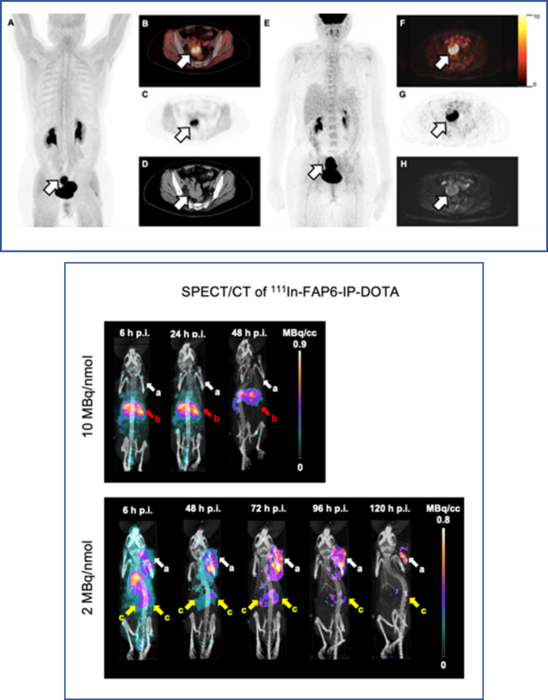 New research: FAPI PET imaging superior for d | EurekAlert!