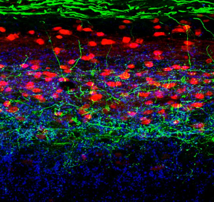 Cross-Section of a Mouse Dorsa [IMAGE] | EurekAlert! Science News Releases