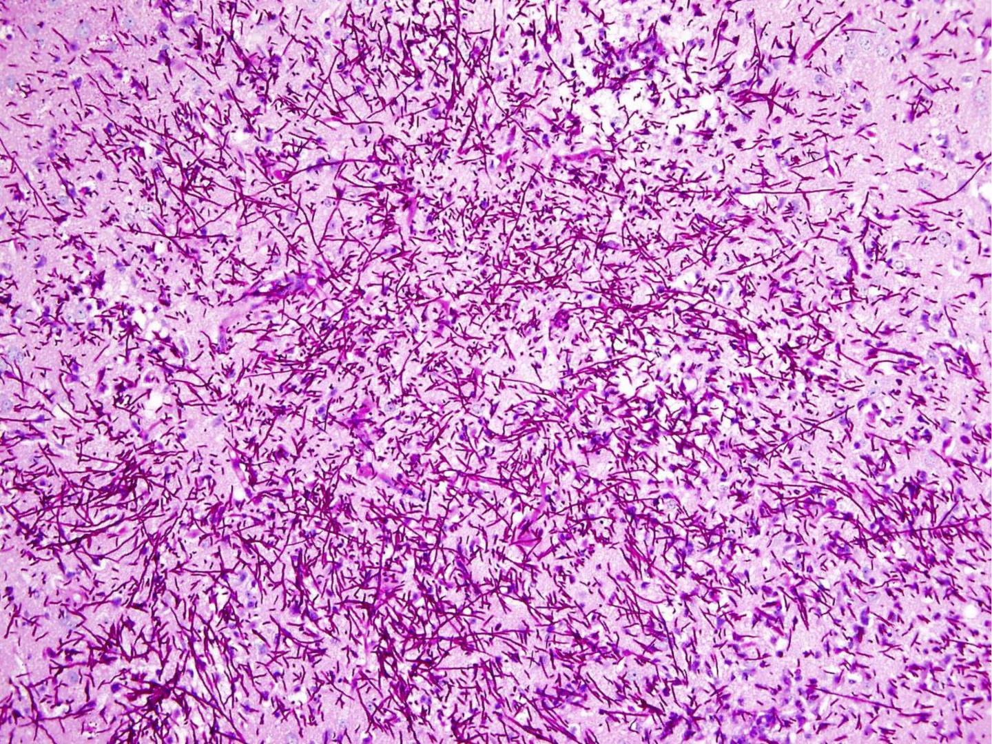 How the brain is protected against fungal pat | EurekAlert!