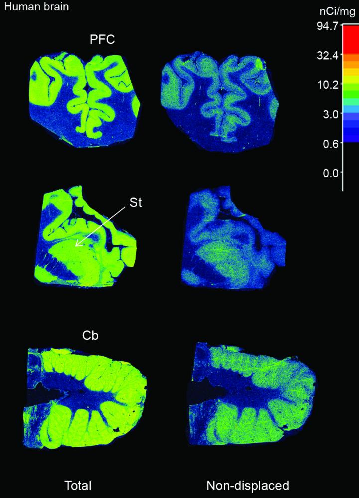 Safer Radioligand Agents Empow [IMAGE] | EurekAlert! Science News Releases