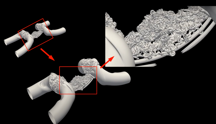 Into the vortex | EurekAlert!