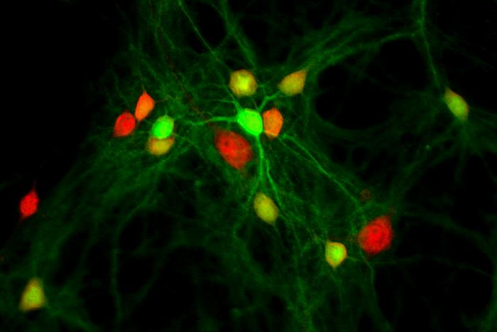 Neural excitement [IMAGE] | EurekAlert! Science News Releases