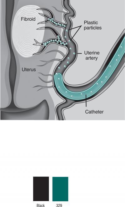 UFE: Closeup View [IMAGE] | EurekAlert! Science News Releases