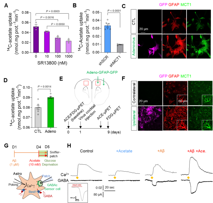 A new breakthrough in Alzheimer disease resea | EurekAlert!