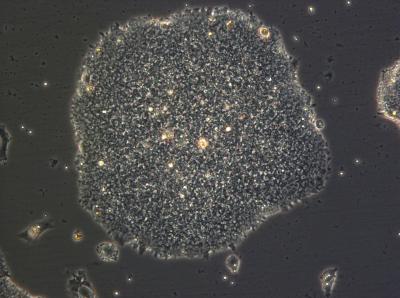 Human Embryonic Stem Cell Colo [IMAGE] | EurekAlert! Science News Releases