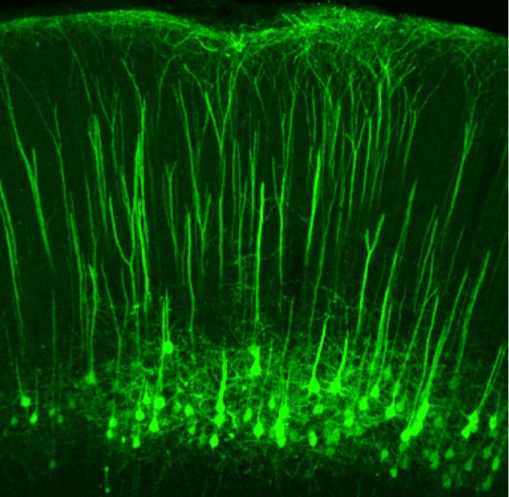 Influencing Touch Perception, [IMAGE] | EurekAlert! Science News Releases