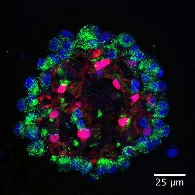 Alveoli Organoid [IMAGE] | EurekAlert! Science News Releases