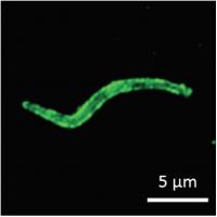 Plasmodium sporozoite [IMAGE] | EurekAlert! Science News Releases
