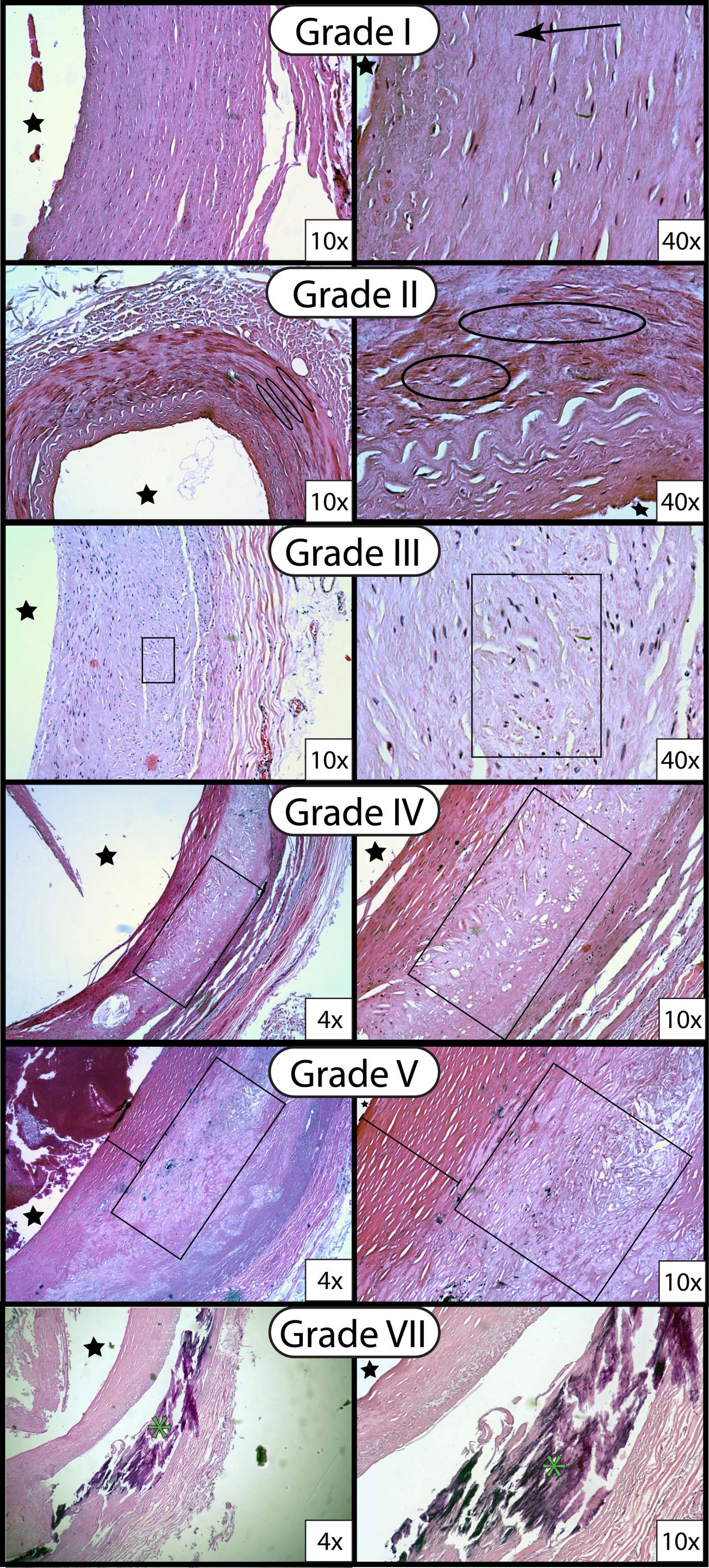 Figure 1 [IMAGE] | EurekAlert! Science News Releases
