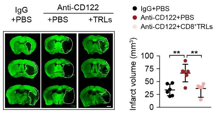 Brain regions affected by isch [IMAGE] | EurekAlert! Science News Releases