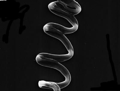 Coiled Fiber [IMAGE] | EurekAlert! Science News Releases