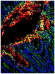 Colonic Crypt Lumen [IMAGE] | EurekAlert! Science News Releases