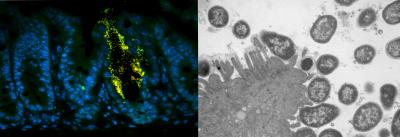 Invading Bacteria Attached to [IMAGE] | EurekAlert! Science News Releases