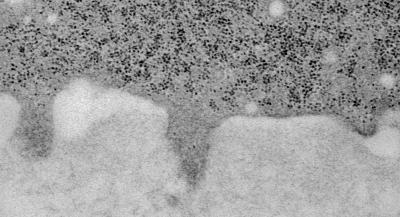 Cancer Cell with Invadopodia [IMAGE] | EurekAlert! Science News Releases