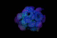 'Mini-guts' offer clues to pediatric GI illne | EurekAlert!