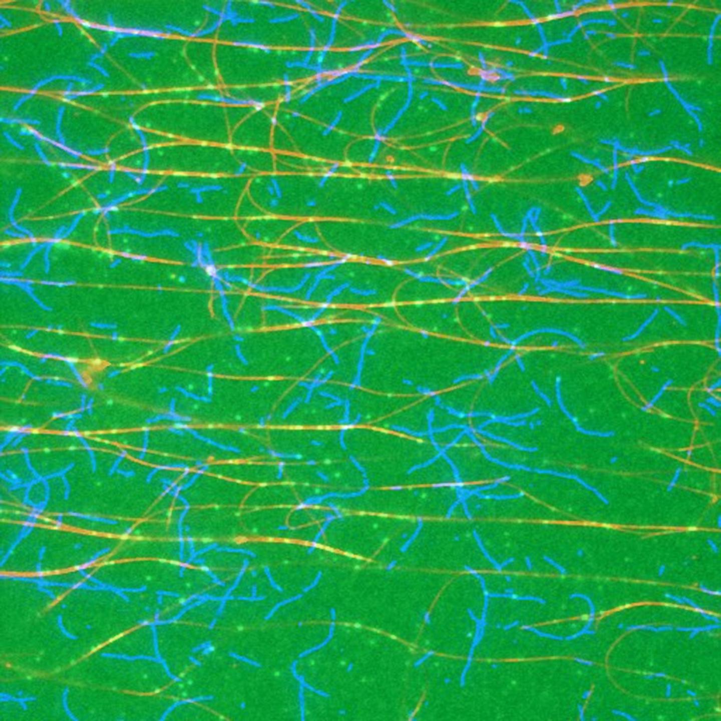 A Cell's Cytoskeleton [IMAGE] | EurekAlert! Science News Releases