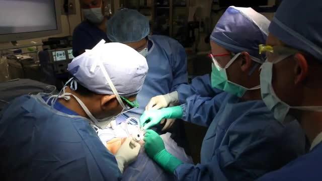 Mount Sinai surgeons remove thyroid gland thr | EurekAlert!