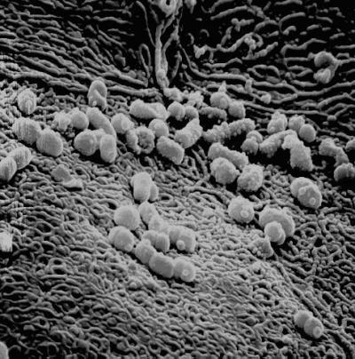 Streptococcus equi [IMAGE] | EurekAlert! Science News Releases