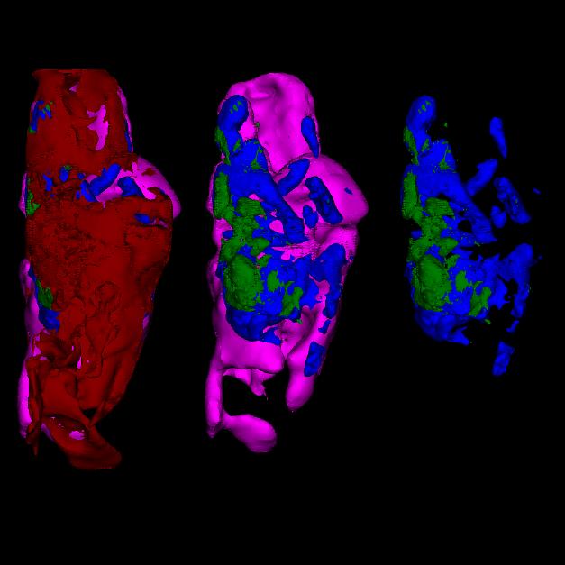 Imaging Atherosclerotic Calcif [IMAGE] | EurekAlert! Science News Releases