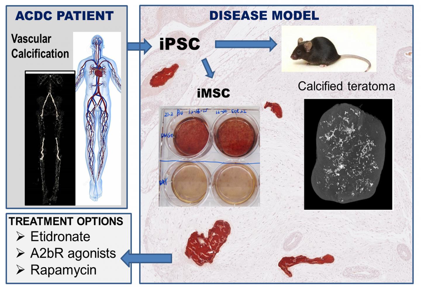 Patient-Derived Stem Cells Reveal Treatment S | EurekAlert!