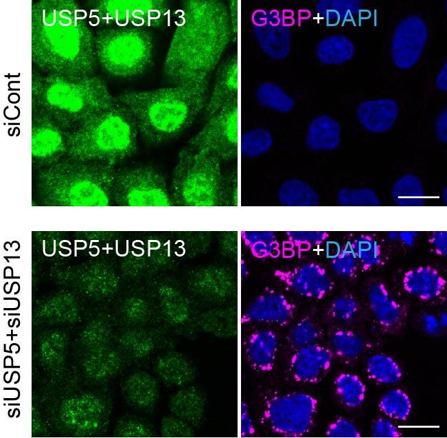 Co-localization in USP5, USP13 [IMAGE] | EurekAlert! Science News Releases