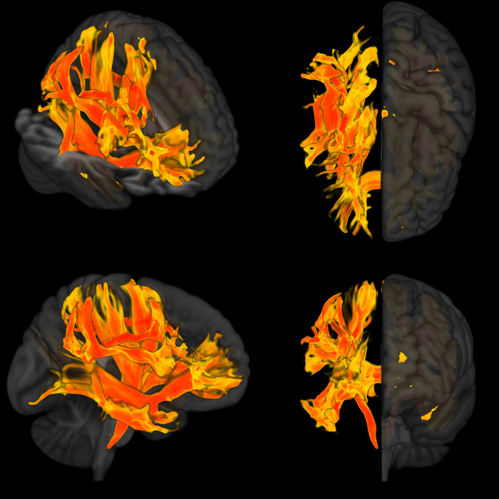 Specific Regions Of The Brain IMAGE EurekAlert Science News Releases